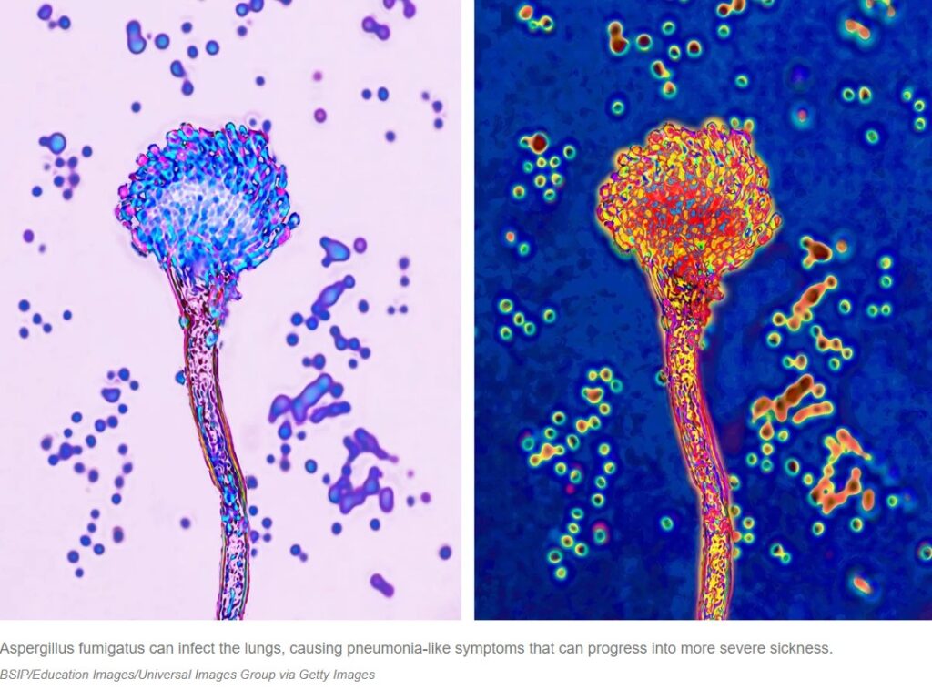 WHO releases list of threatening fungi. The most dangerous might ...